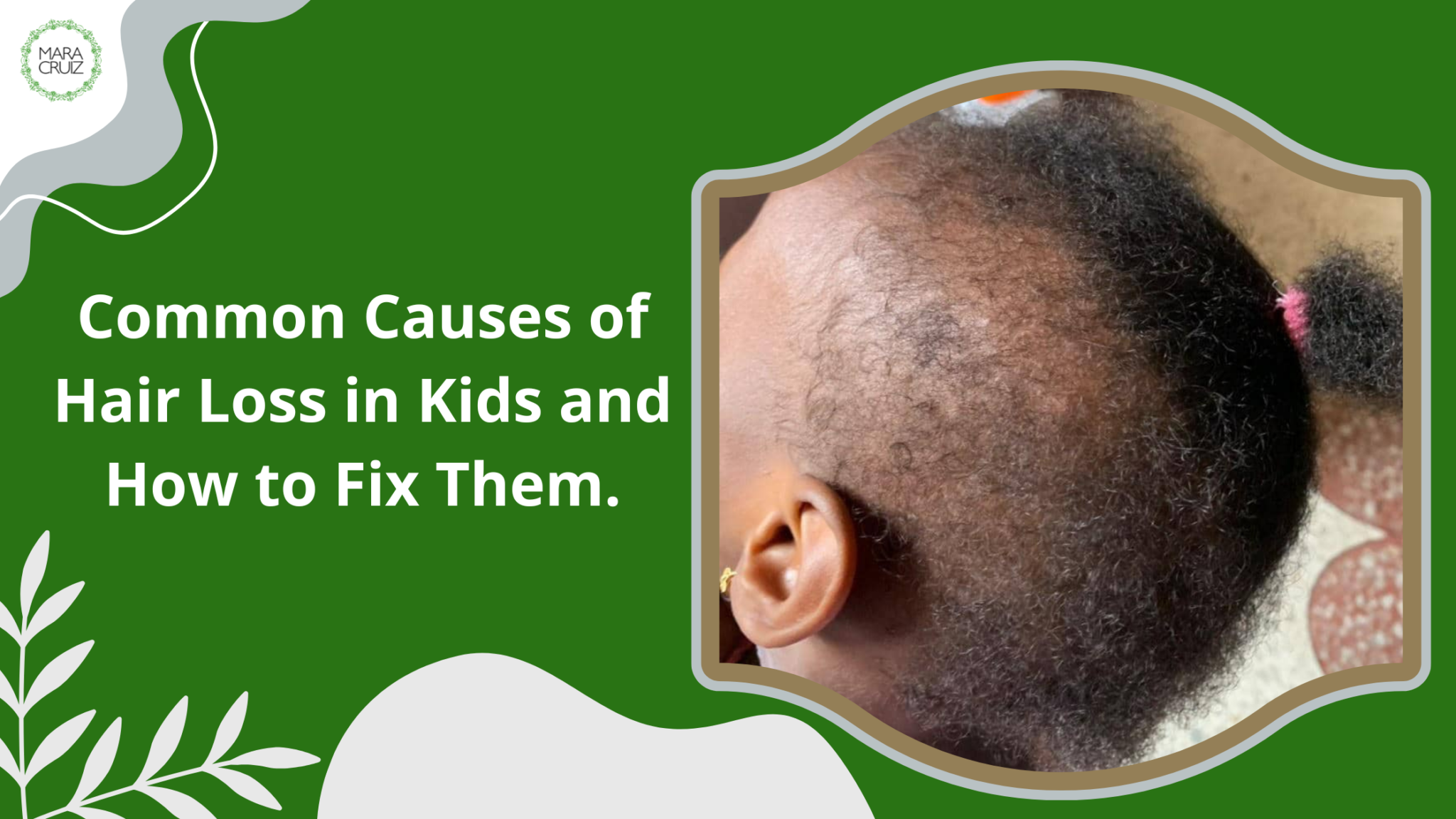 Why Is My Child Losing Hair? 5 Common Causes of Hair Loss in Kids and ...